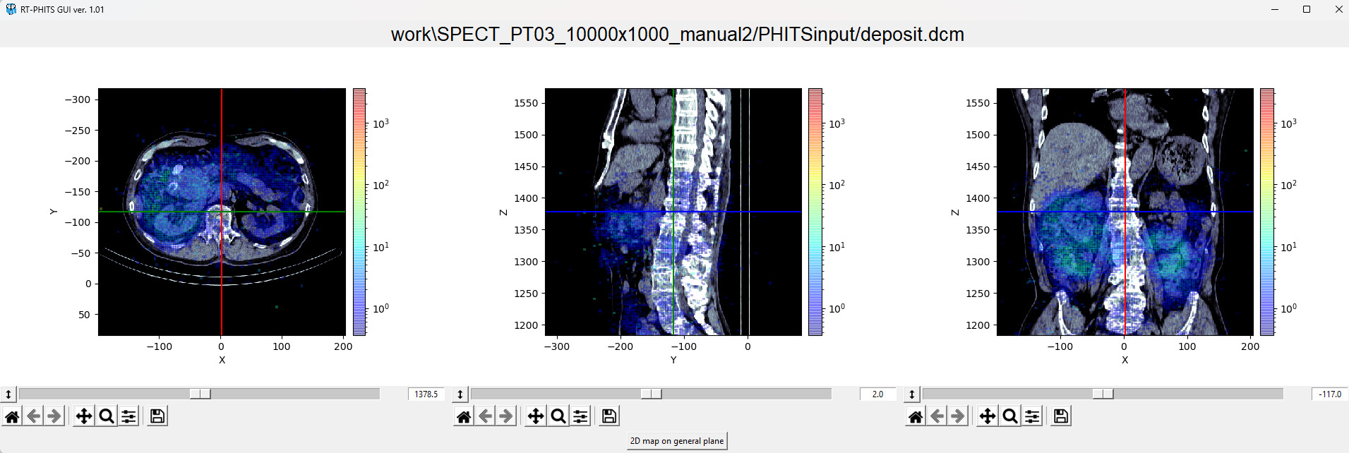 Error on running input file of RT-PHITS - Questions - PHITS Forum