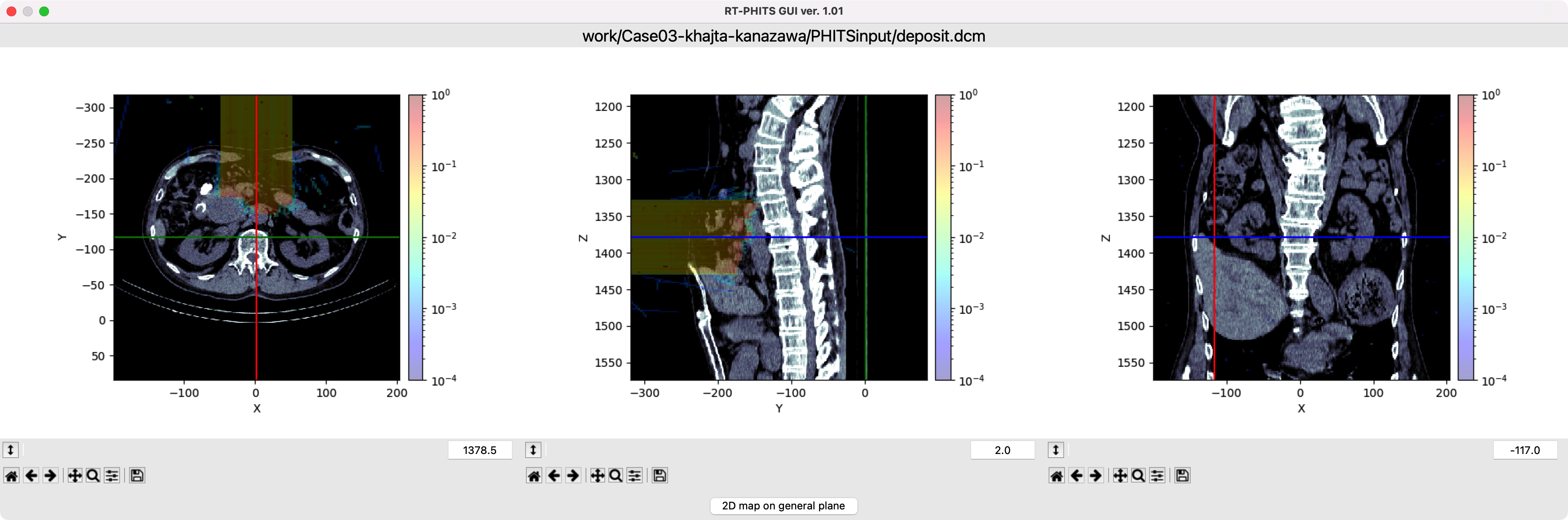 Error on running input file of RT-PHITS - Questions - PHITS Forum